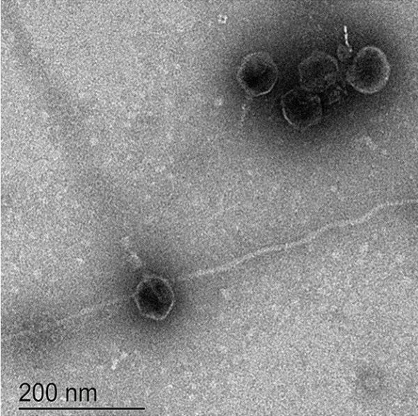 Personalized Bacteriophage Therapy Against Pandrug Resistant Spinal